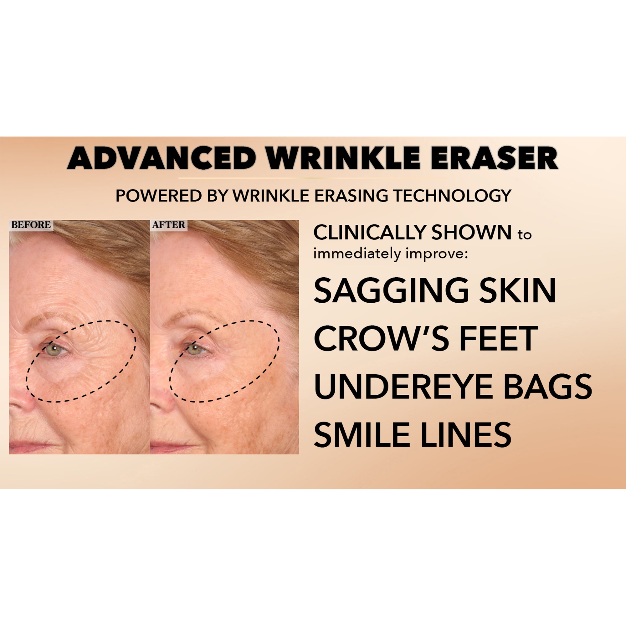 Nakery Skip The Line Advanced Instant Wrinkle Eraser - TSC.ca