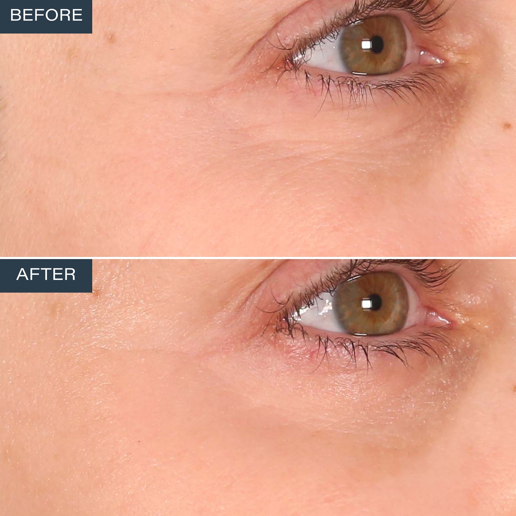 SKINN Age Reset Anhydrous Eye Balm - TSC.ca