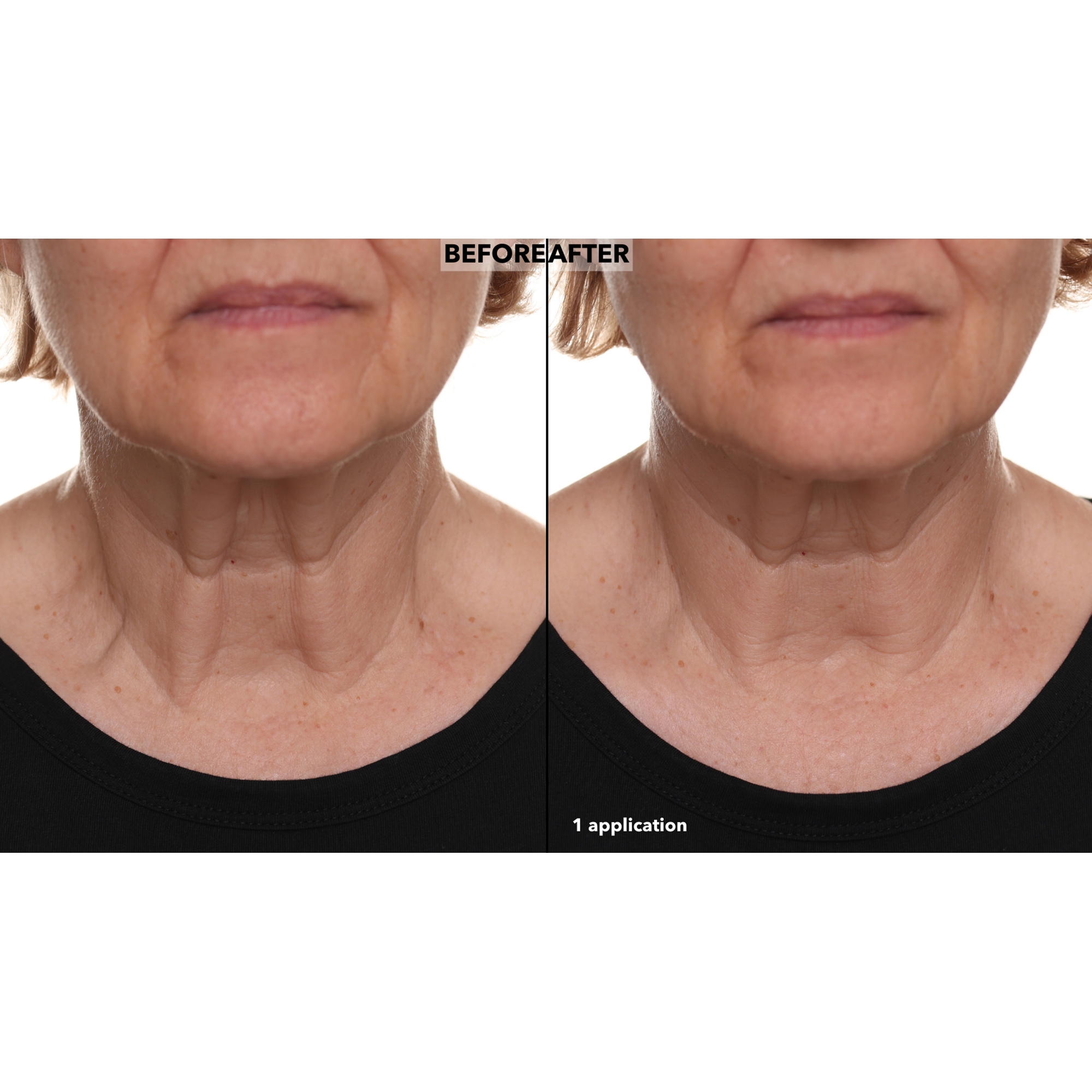 Nakery Lift-Tox Face and Eye Bundle - TSC.ca