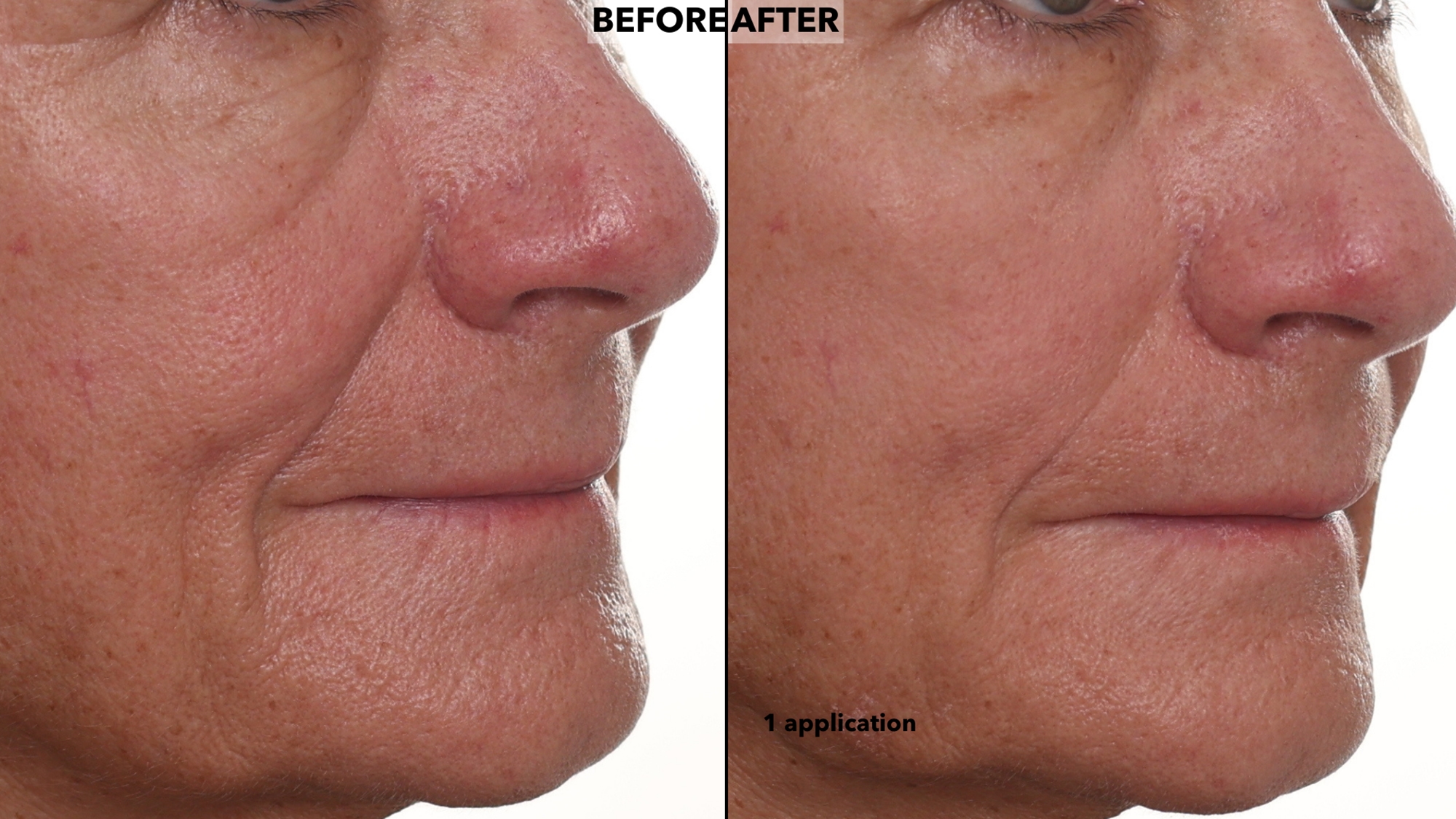 Nakery Lift-Tox Face and Eye Bundle - TSC.ca