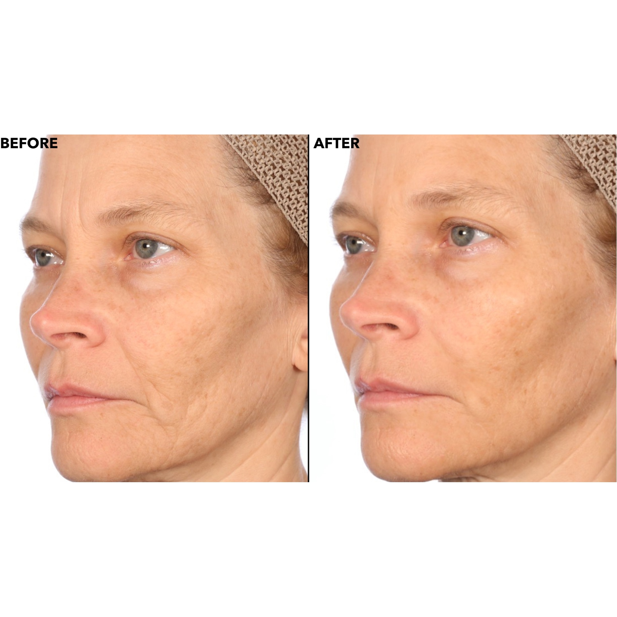 Nakery Collagen Defense + 25% Vitamin C Complex Serum - TSC.ca